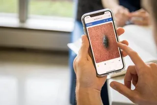 App to help medical students spot skin cancer | Halldale Group